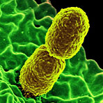 Hamburg: Multiresistente Keime bei 18 Patienten