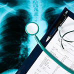 Zukunftspreis für Riociguat | PZ – Pharmazeutische Zeitung