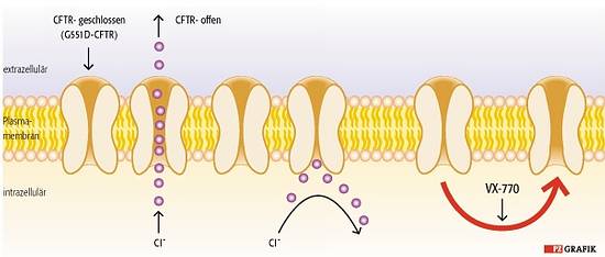 Neue Ansätze bei Mukoviszidose | PZ – Pharmazeutische Zeitung