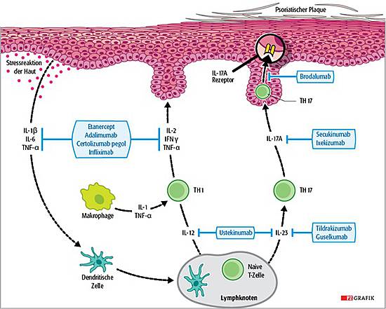 Neue Therapien im Vergleich | PZ – Pharmazeutische Zeitung
